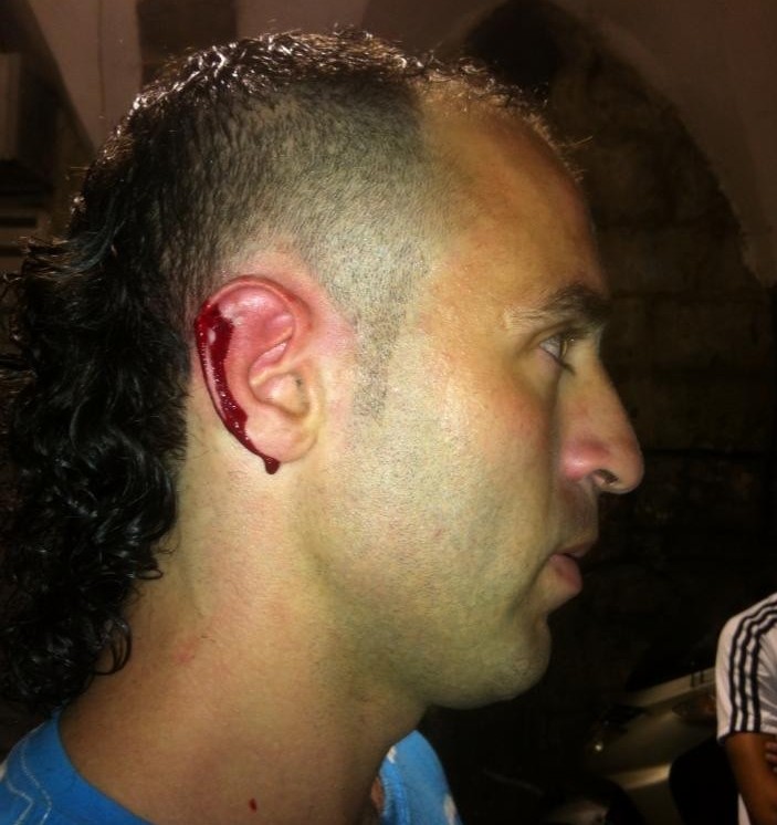 Raiding houses in the old city of Jerusalem and the injury of a woman